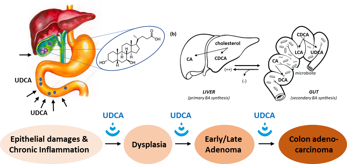 New publication: Ursodeoxycholic acid and cancer: From chemoprevention ...